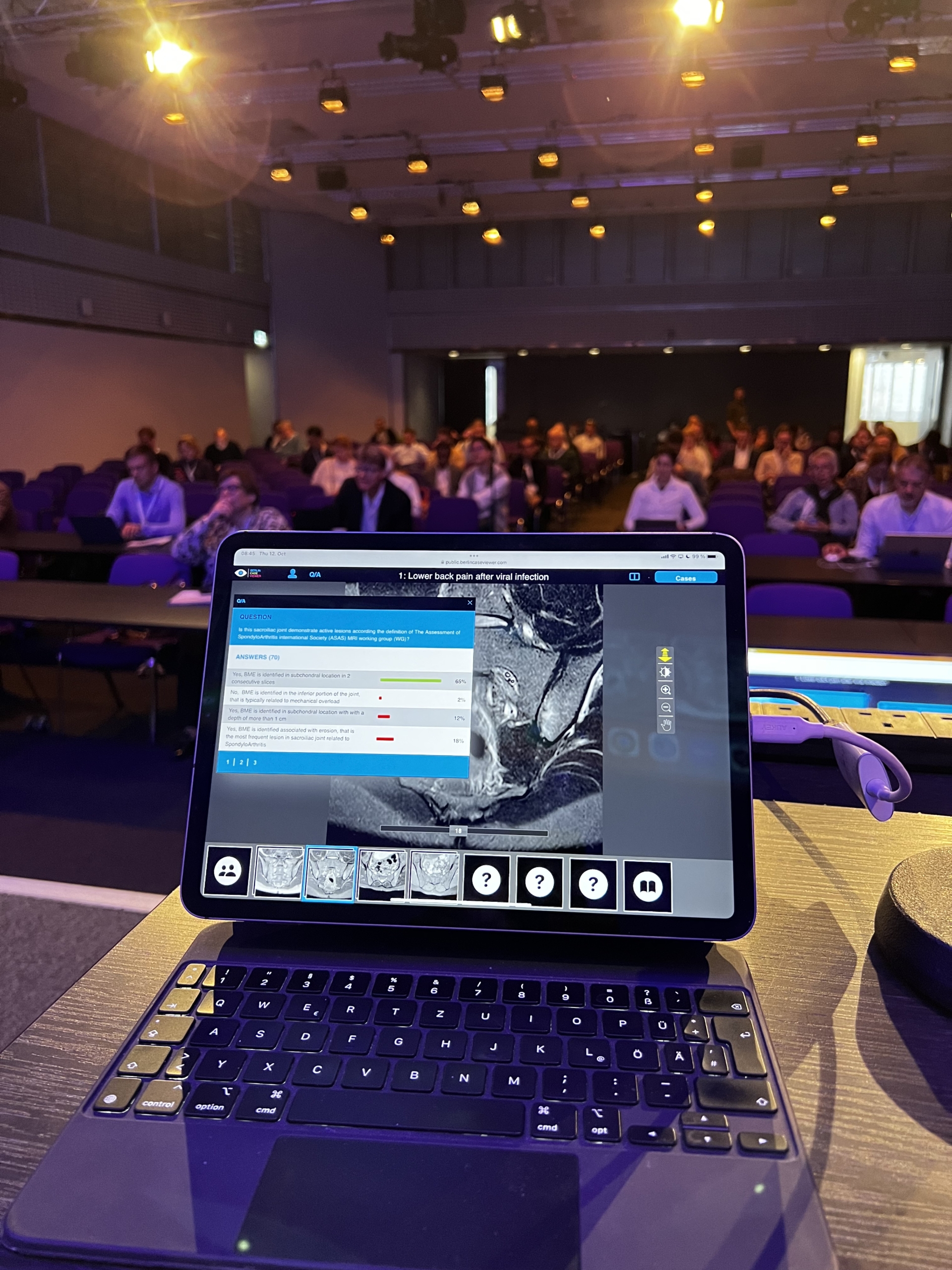 Rays of Progress: A Radiology Learning Journey Through 2023 | BerlinCaseViewer