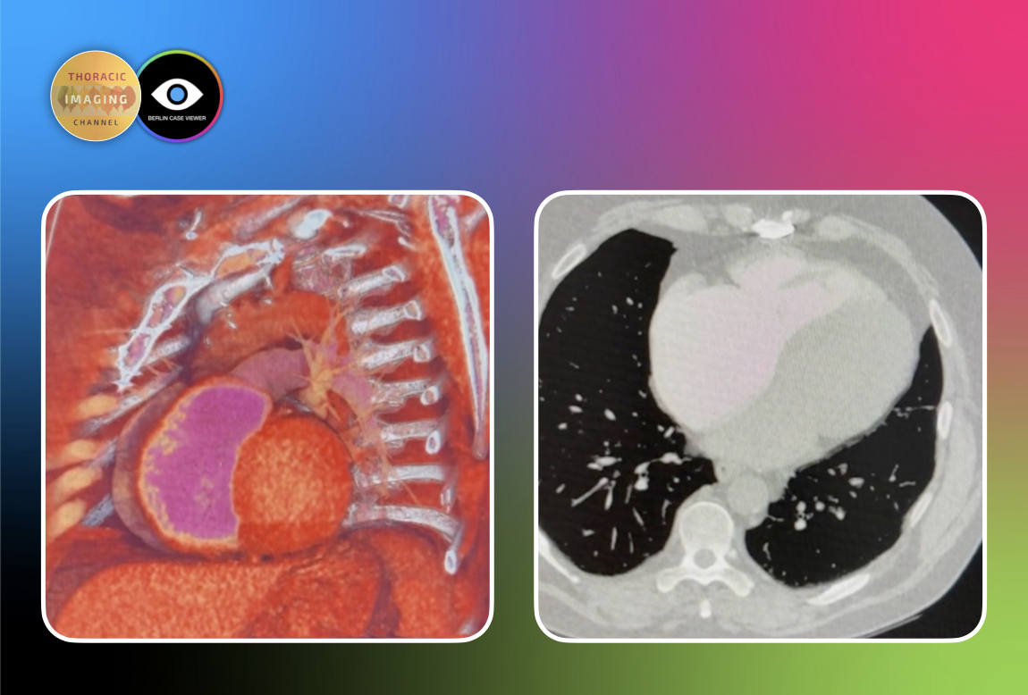 Online Academy | BerlinCaseViewer