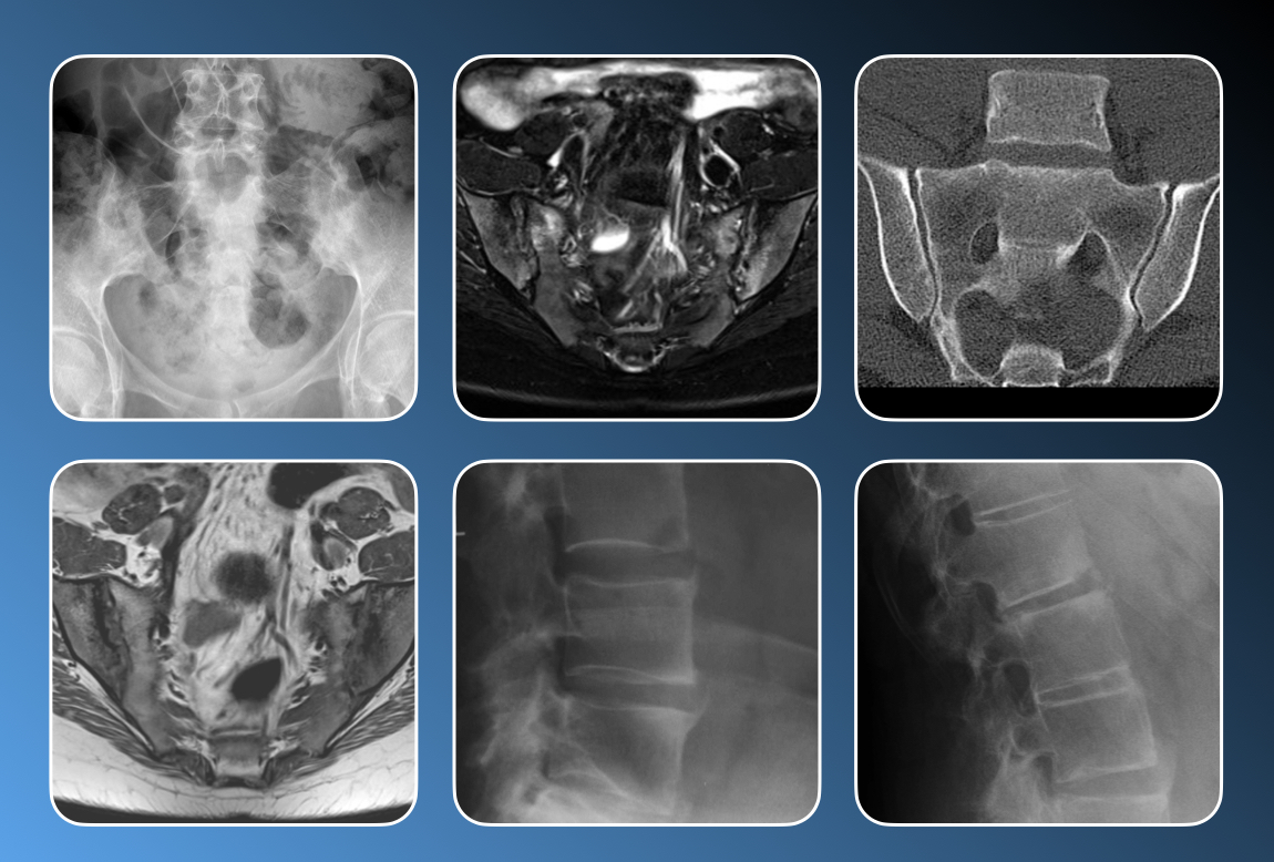 Rheuma Day Pre-Learning - Axial Skeleton | BerlinCaseViewer by ...